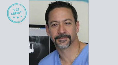 Protecting the Bone Around Dental Implants: Preserving Support and ...
